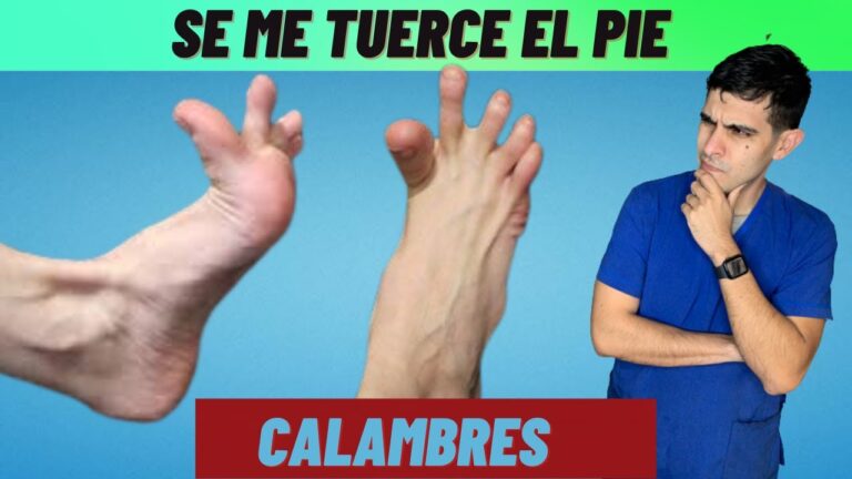 Calambres en el Arco del Pie: Causas, Síntomas y Soluciones Efectivas ...