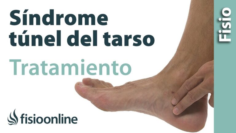 ¿Qué es el seno del tarso? Todo lo que necesitas saber sobre esta ...