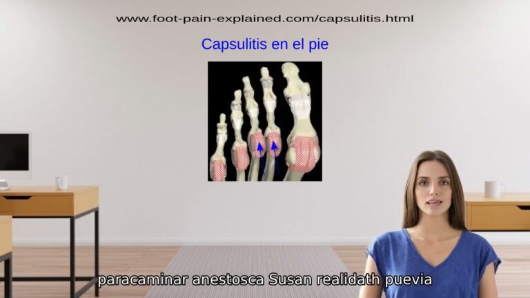 Capsulitis del Segundo Dedo del Pie: Síntomas, Causas y Tratamientos ...