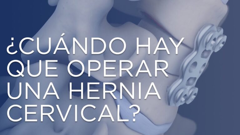Cómo se Opera una Hernia Cervical: Guía Completa y Pasos Esenciales ...