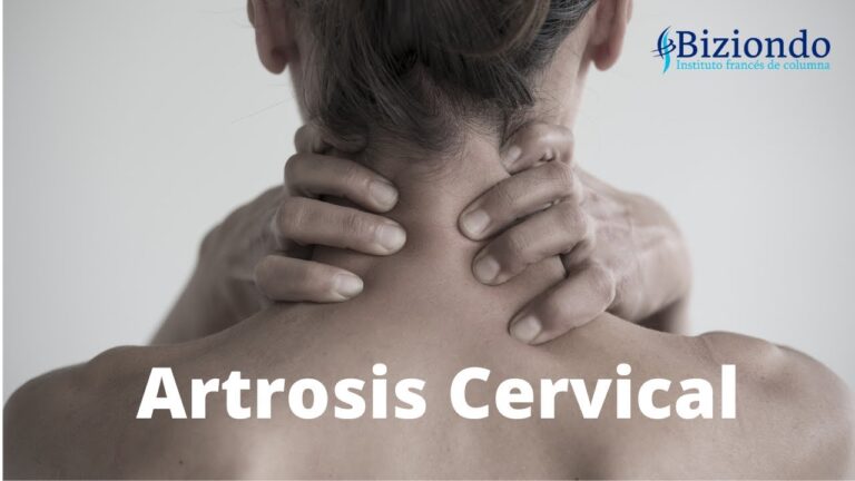 Cuáles son los Síntomas de Artrosis Cervical: Guía Completa para ...