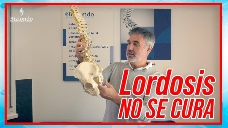 ¿Qué es la rectificación de la lordosis fisiológica? Descubre su ...