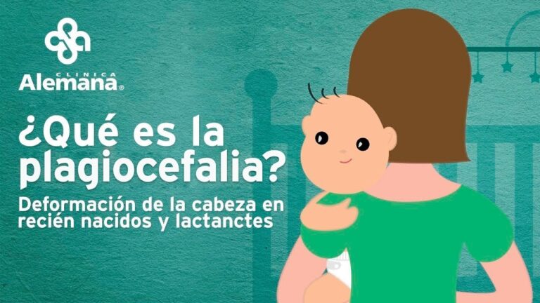 Deformaciones en la Cabeza del Bebé: Causas, Prevención y Tratamientos ...