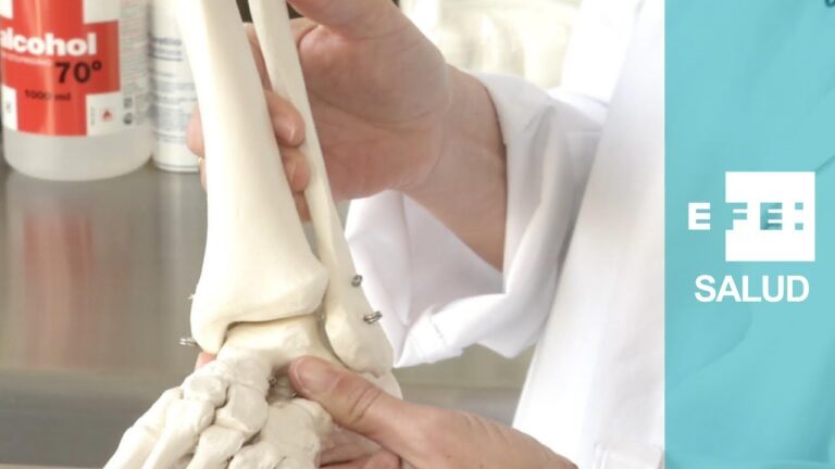 Fractura de Tobillo: Guía Completa sobre la Lesión de Tibia y Peroné ...