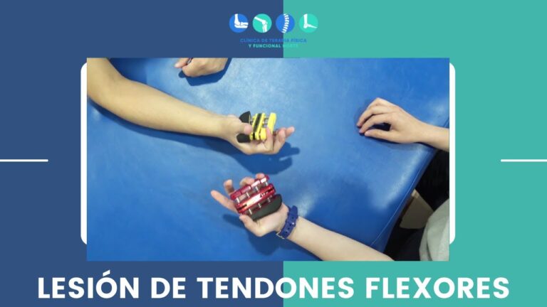 Lesión en Tendones Flexores de la Mano: Causas, Síntomas y Tratamientos ...