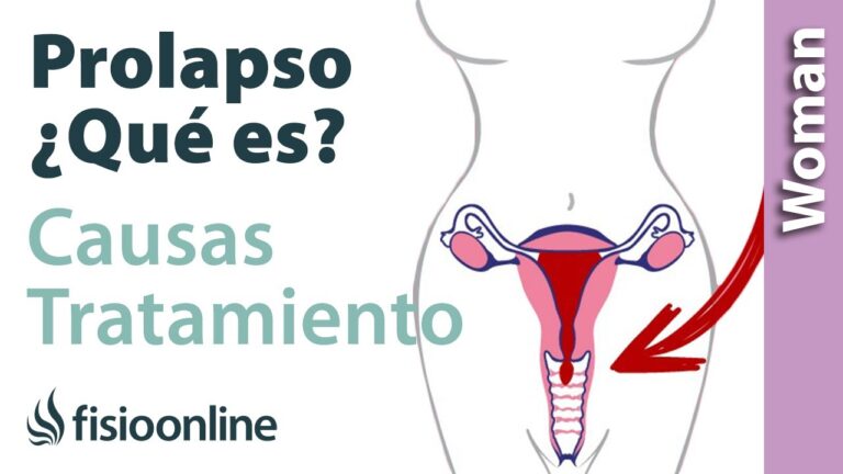 ¿Qué es el prolapso de útero? Causas, síntomas y tratamientos efectivos - Blog sobre Ortopedia