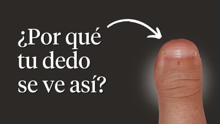 Tipos de Dedos Pulgares: Significado y Características que Debes ...