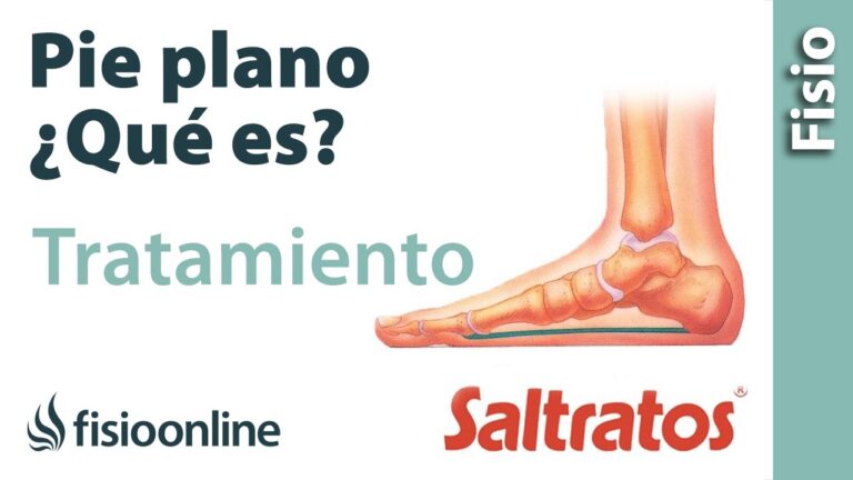 Guía Completa sobre el Tratamiento del Pie Plano en Adultos: Opciones y ...
